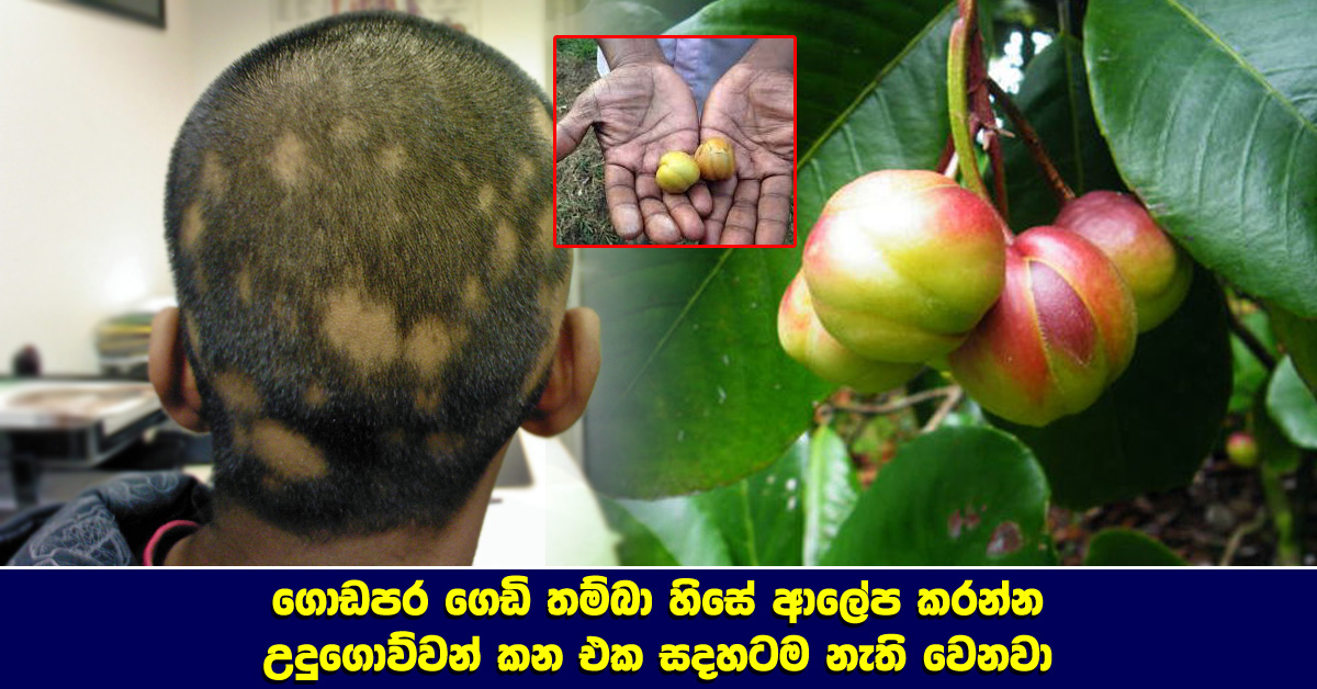 Godapara | Health & Lifestyle Magazine | sriarana.net