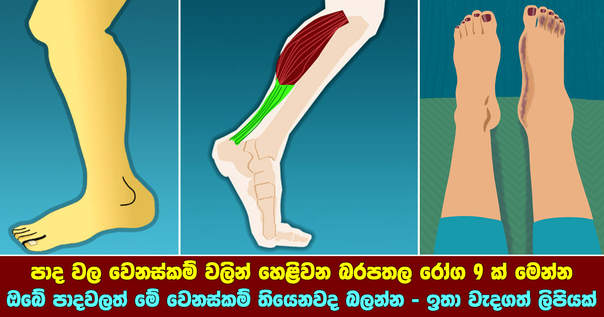 Here are 9 serious diseases that are revealed by changes in the legs ...