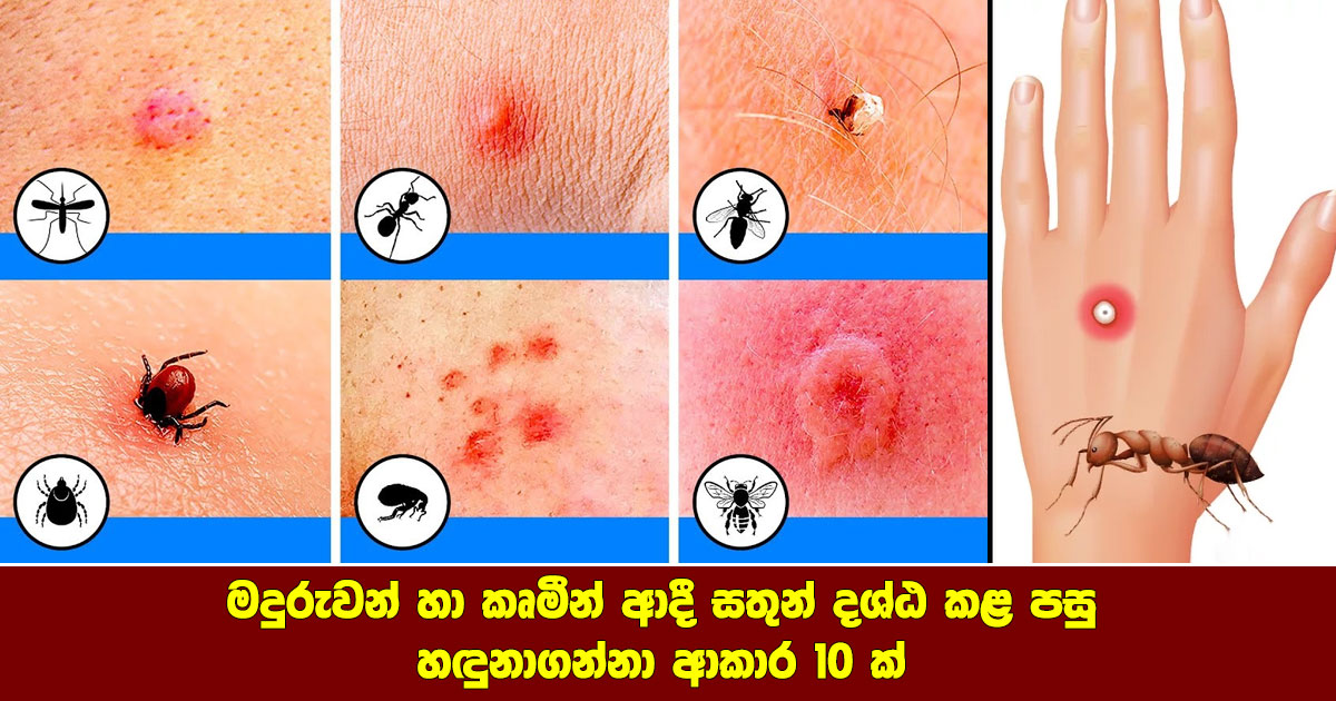 10 Ways to Identify Animal Bites | Health & Lifestyle Magazine ...